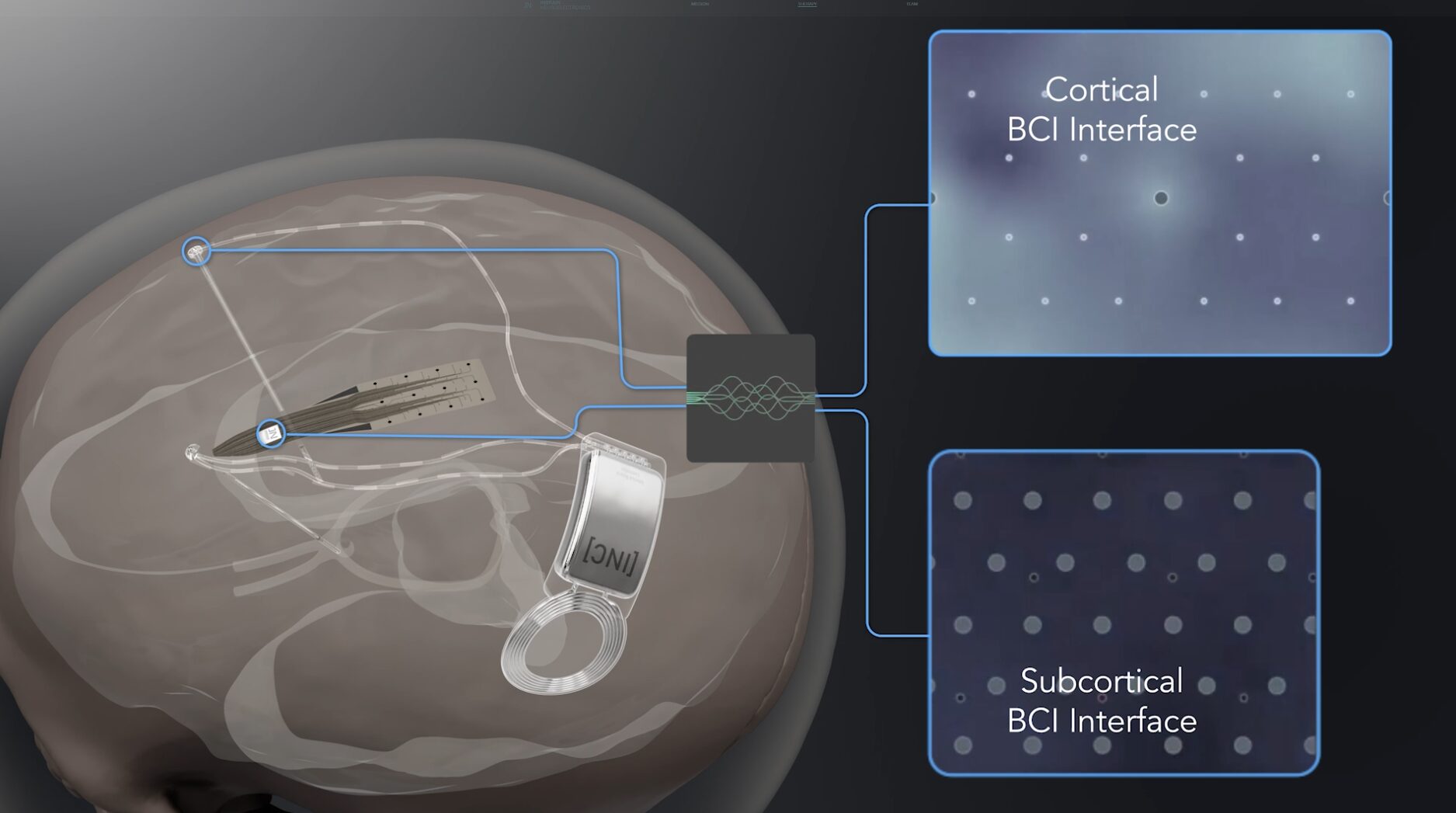 INBRAIN Closes $50M Series B to Advance Graphene BCI Tech